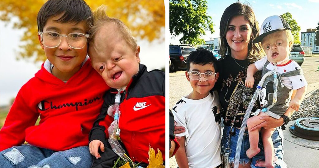 "Au-Delà des Apparences : La Résilience Inspirante de Raedyn et de sa ...