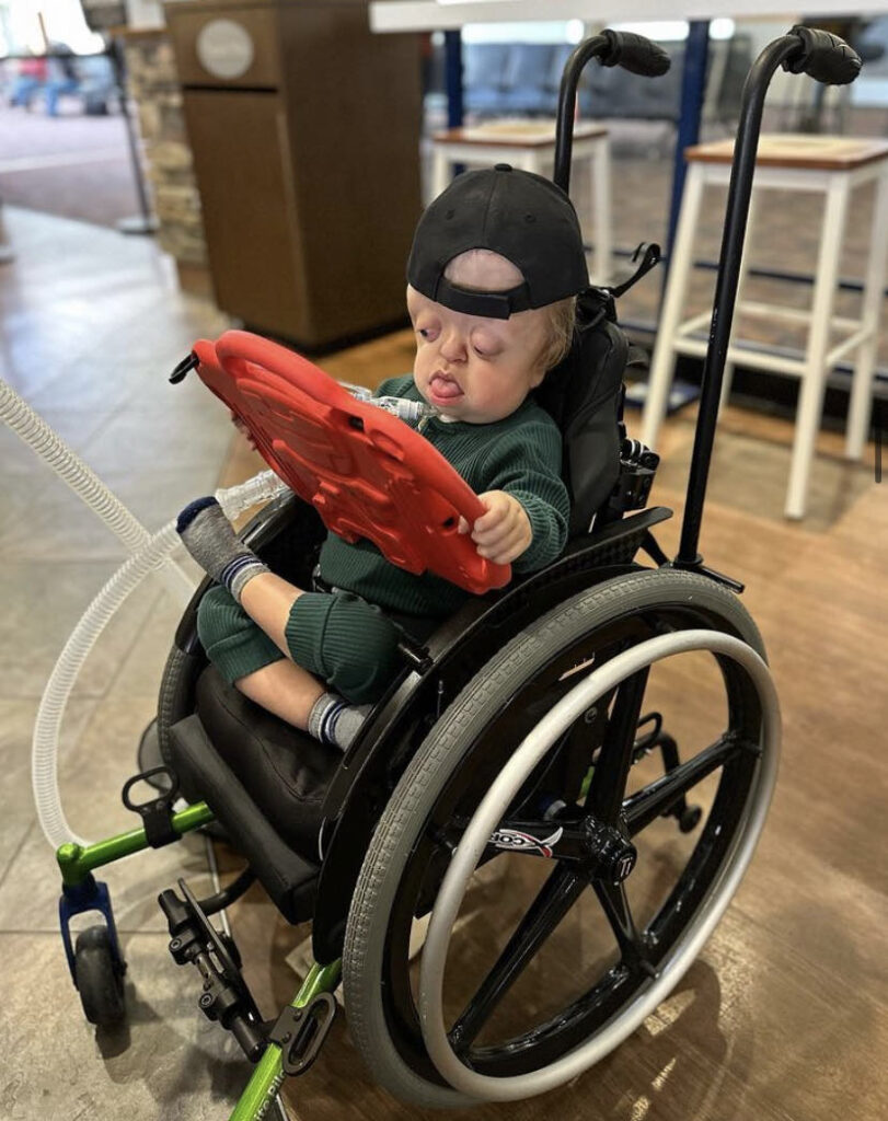 "Au-Delà des Apparences : La Résilience Inspirante de Raedyn et de sa ...